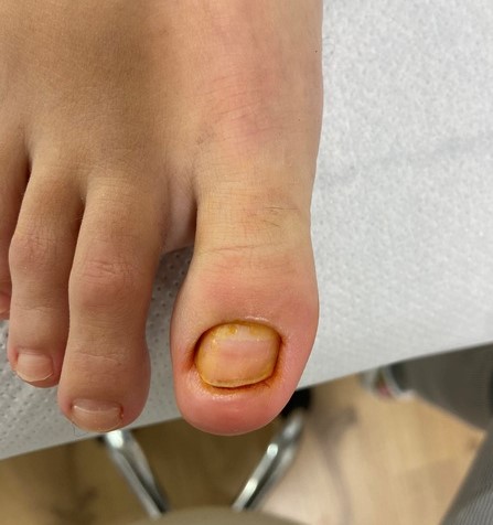 Retronichia – DOTT.SSA REBECCA CARRAI